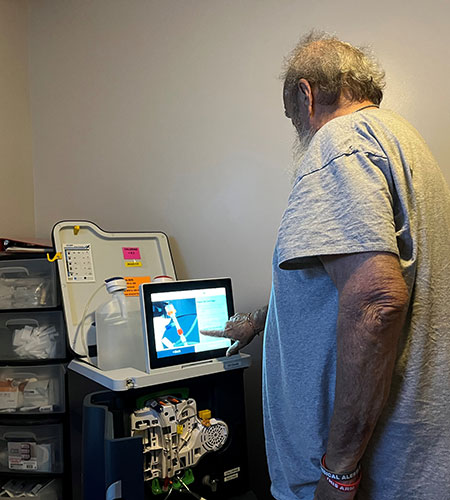 Meet One of the First Home Hemodialysis Patients in Southeastern Iowa